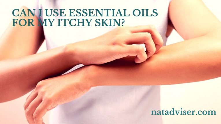 13 Best Essential Oils for Itchy Skin: Recipes & Application Tips ...